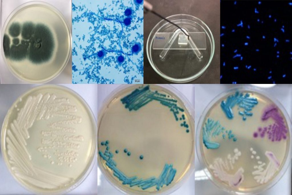 Rapid immunochromatography test (ICT) for serological diagnosis of ...